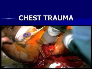 CHEST INJURY | PDF