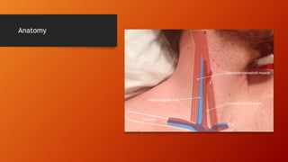 Chest Tube | PDF