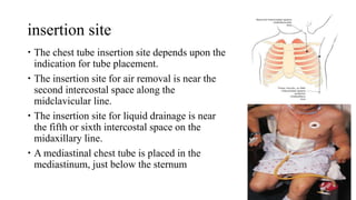 chest tube.pptx