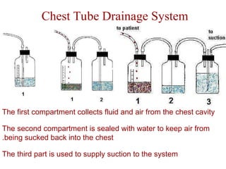 chest tube.power point presentation..... | PPT