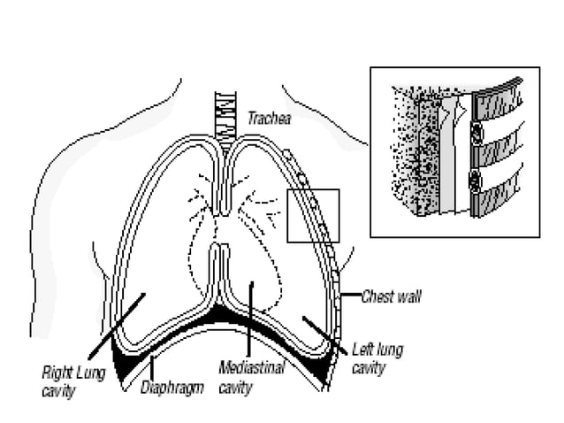 chest tube.power point presentation..... | PPT