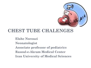 chest tube insertion challenges in neonates | PPTX