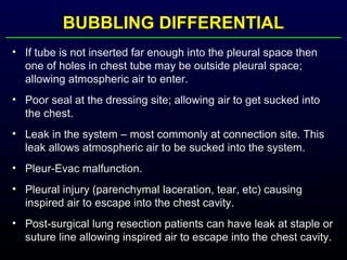Chest Tube In-Service | PPT