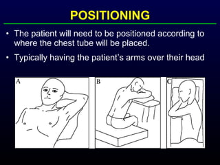 Chest Tube In-Service | PPT