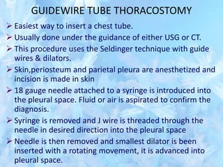 Chesttubedrainage | PPT