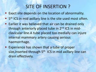 Chesttubedrainage | PPT