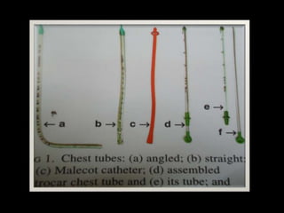Chesttubedrainage | PPT