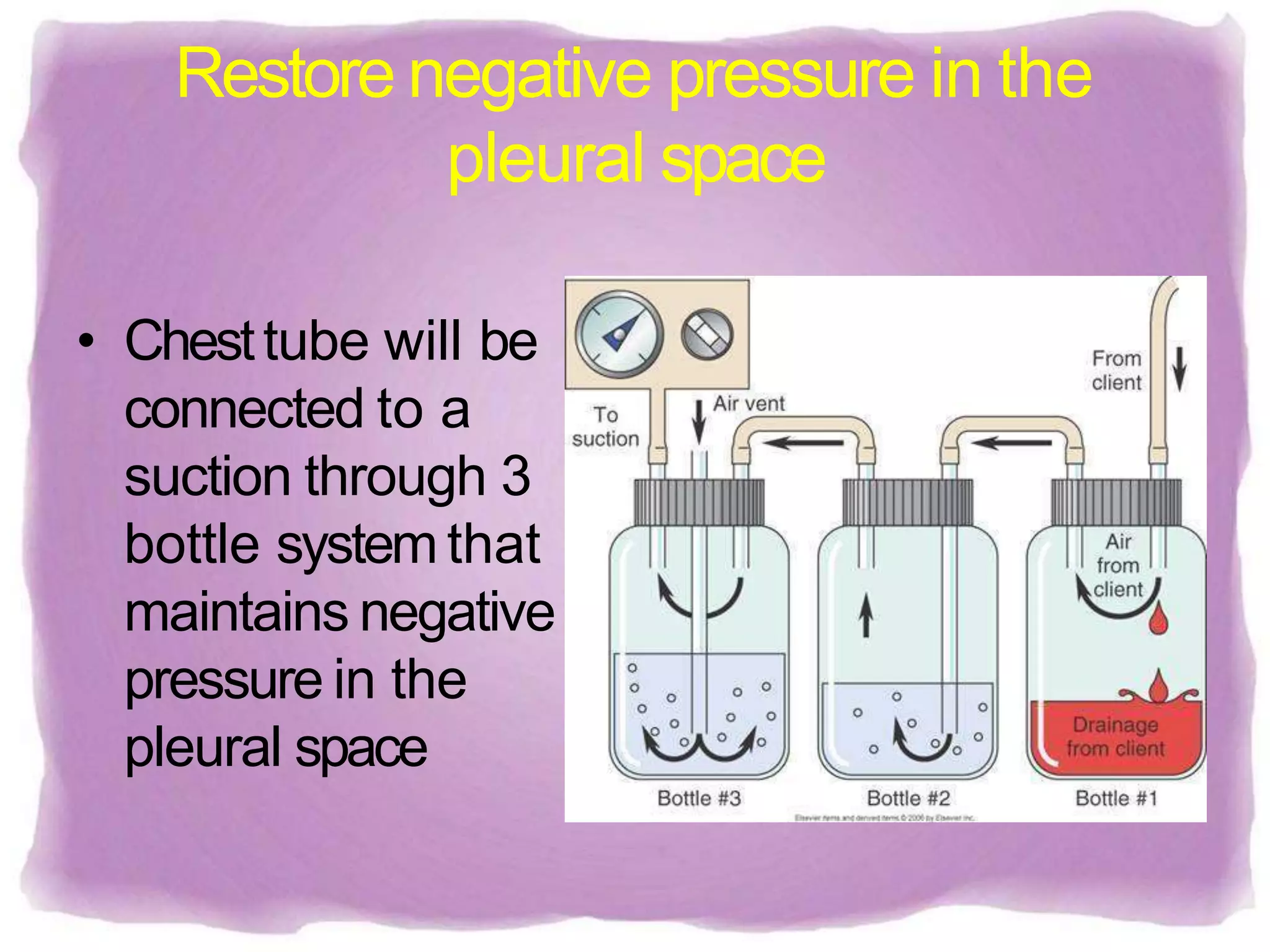 Chest tube drainage | PPTX