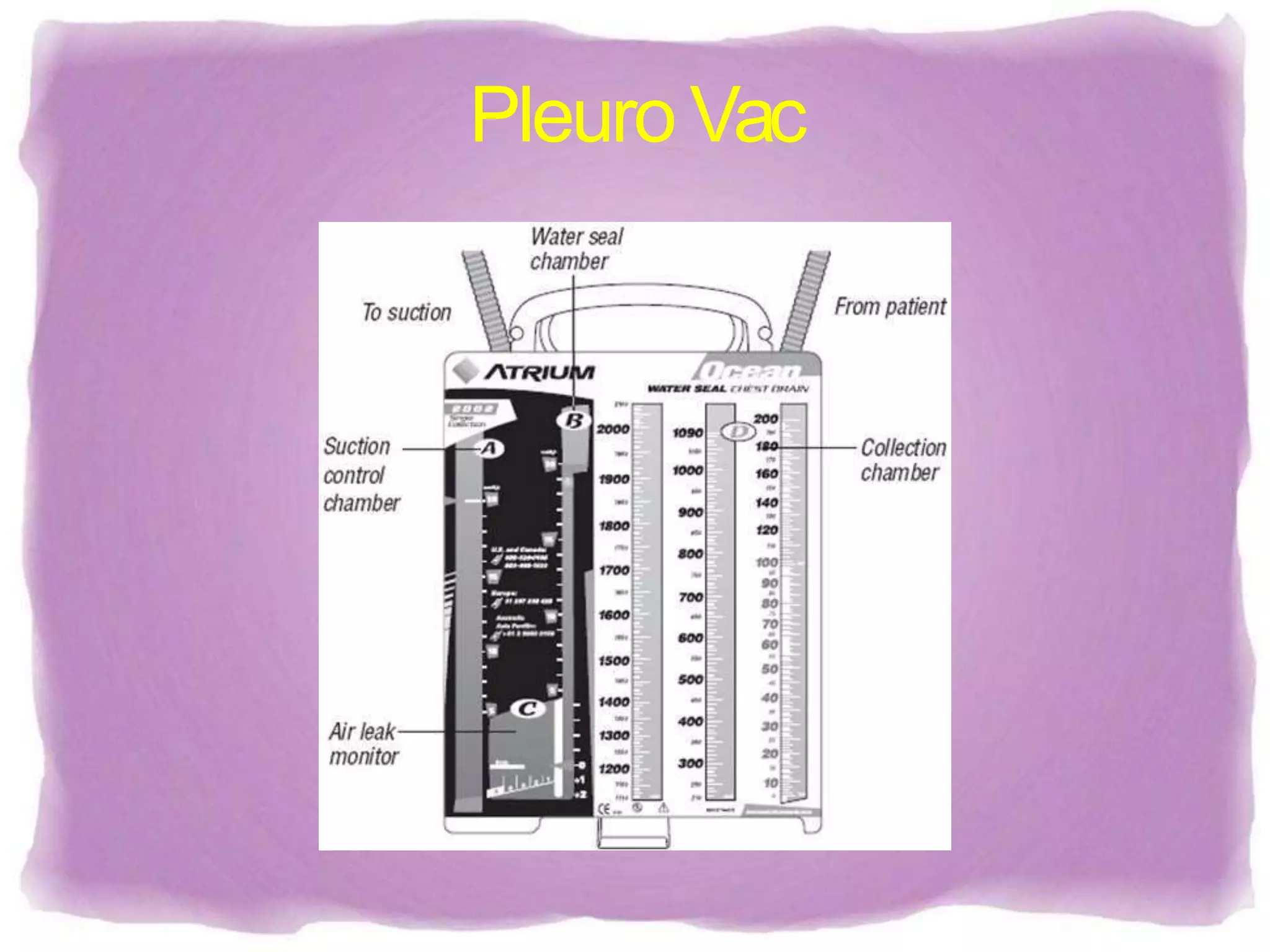 Chest tube drainage | PPTX