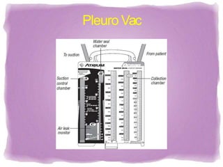 Chest tube drainage | PPTX