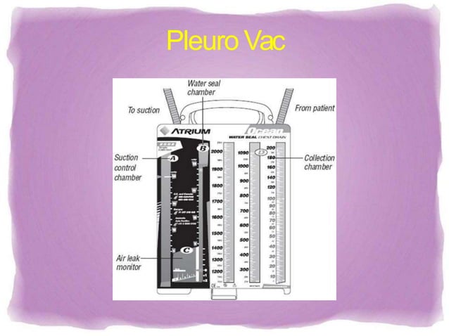 Chest tube drainage | PPTX