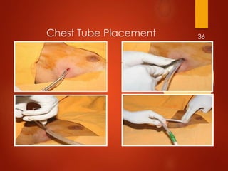 chest tube drainage2 uses and indecation | PPTX