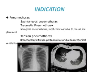 Chest tube insertion | PPTX