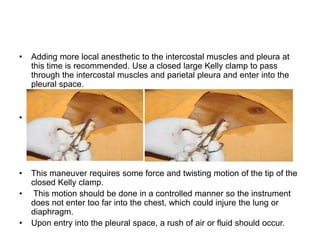 Kelly Clamp Chest Tube