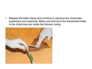 Kelly Clamp Chest Tube