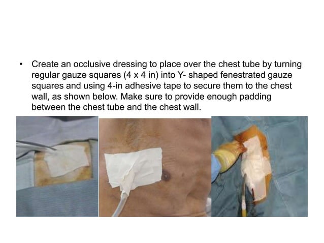 Chest tube insertion