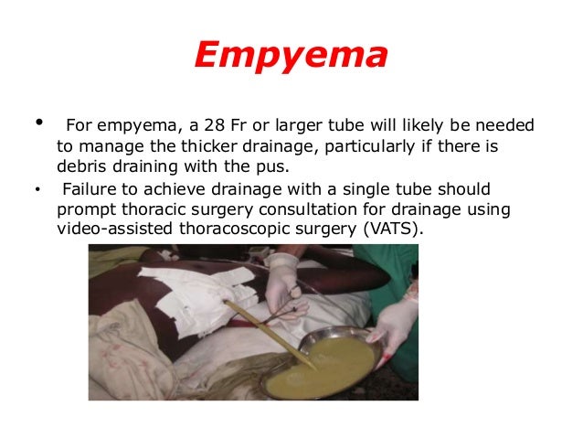 Chest tube insertion