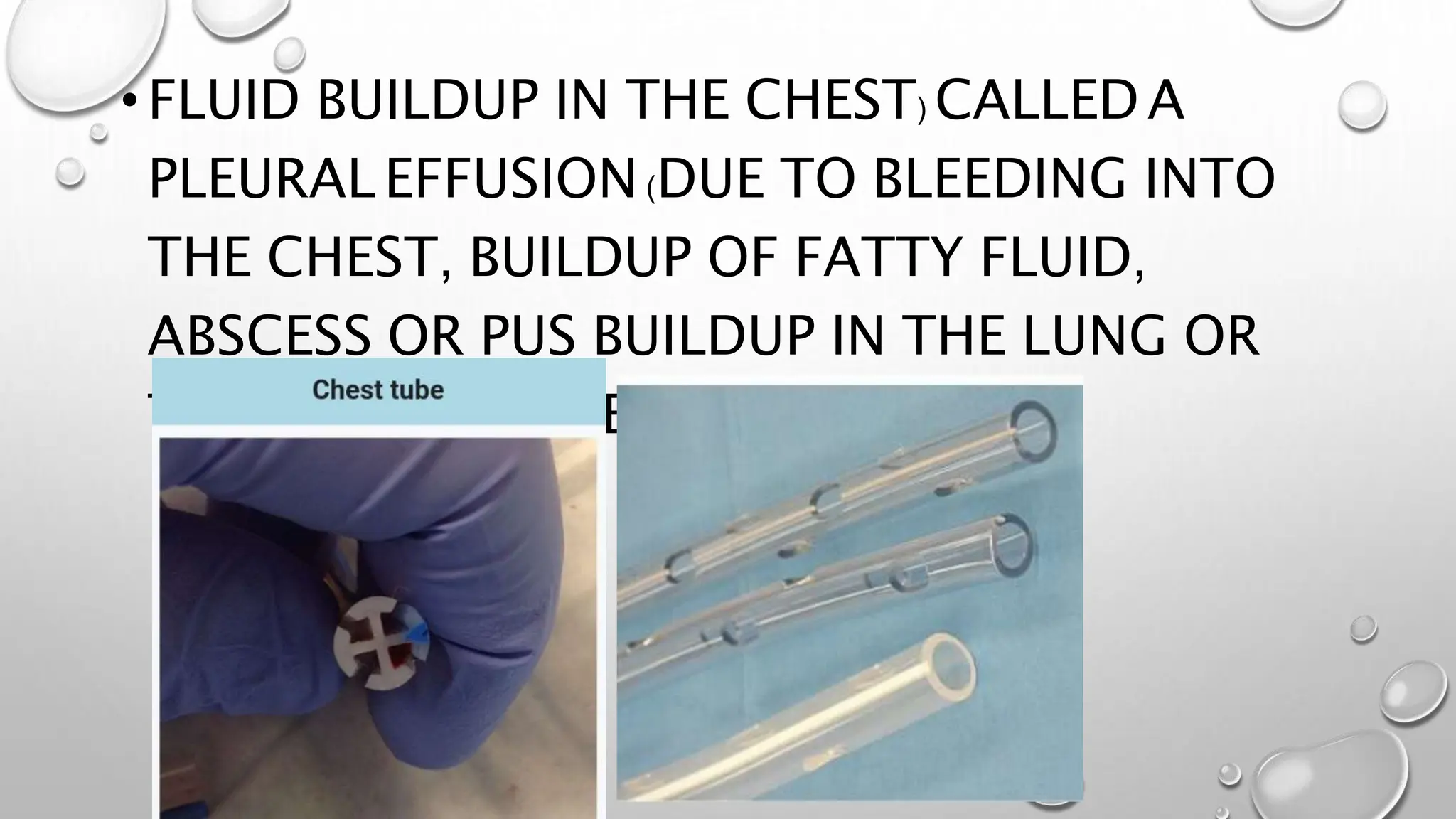 Chest tube insertion care important to me | PPTX