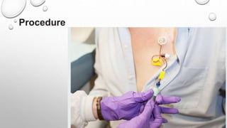 Chest tube insertion care important to me | PPTX