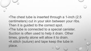 Chest tube insertion care important to me | PPTX