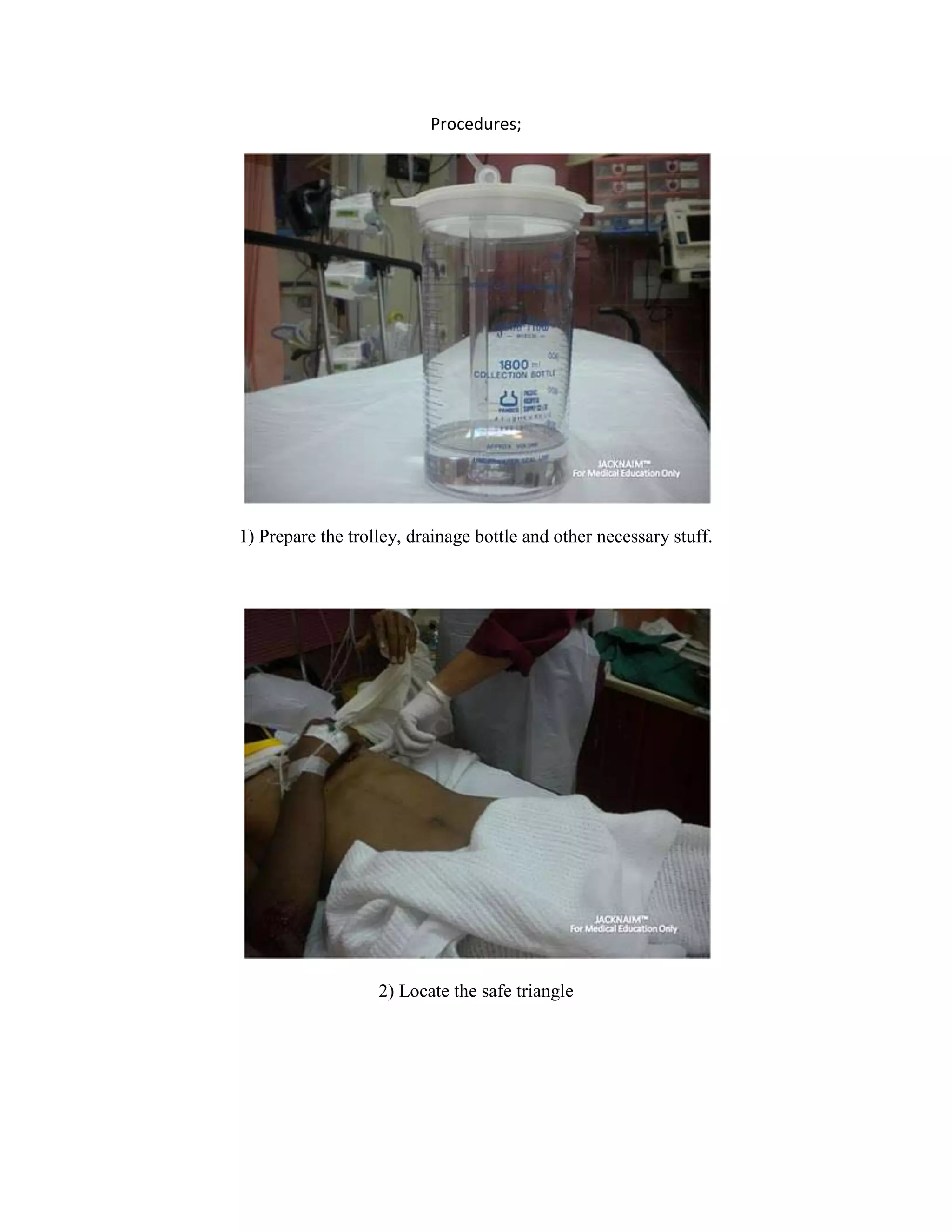 Chest Tube Insertion Made Easy | DOCX