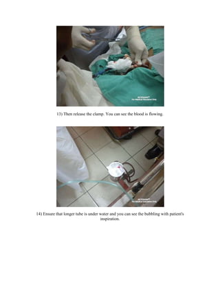 Chest Tube Insertion Made Easy | PDF