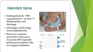 Intercostal Drainage Tubes -Indications,methods,uses | PPTX