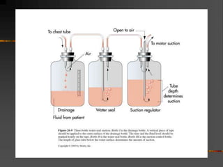 ChestTubes and the drainages - Nursing Care | PPT