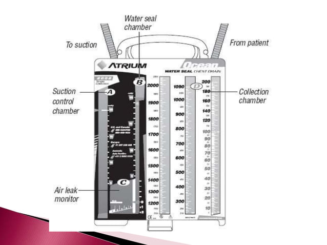 Chest tubes dmw | PPT