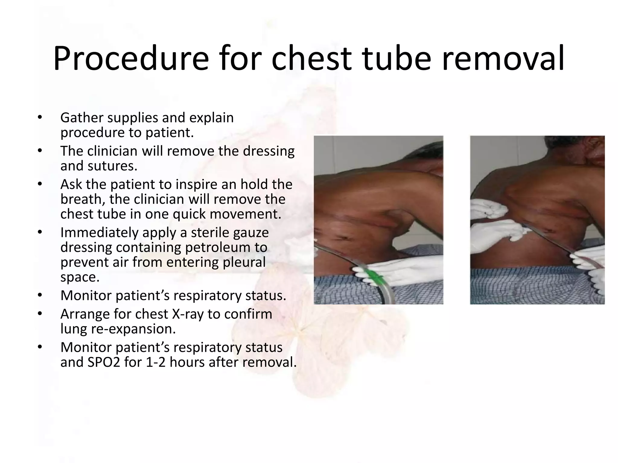 Chest tube insertion ppt (surgery) | PPTX
