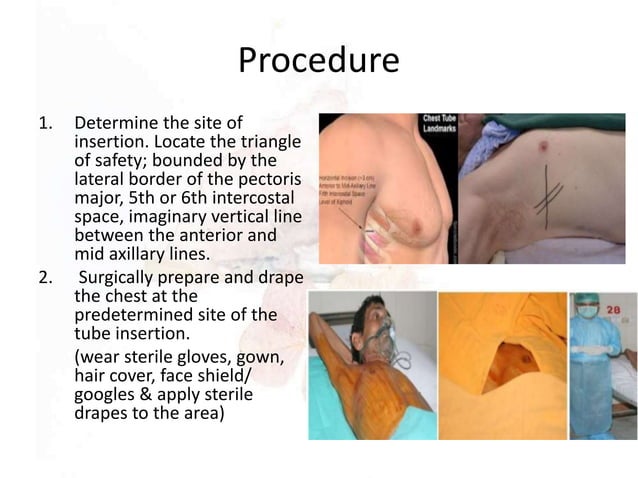 Chest tube insertion ppt (surgery) | PPTX