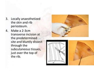 Chest tube insertion ppt (surgery) | PPTX