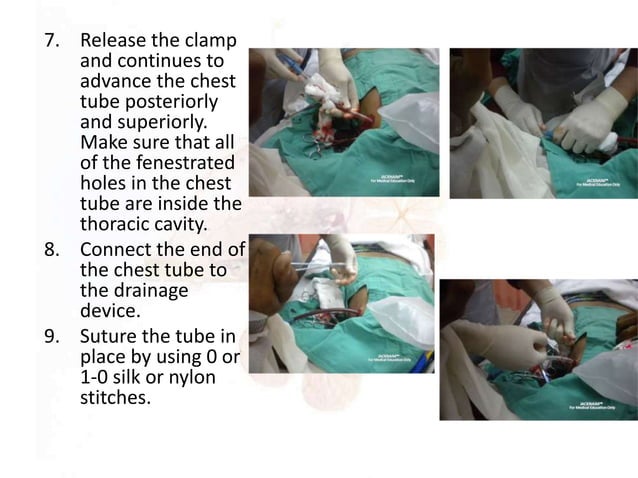Chest tube insertion ppt (surgery) | PPTX
