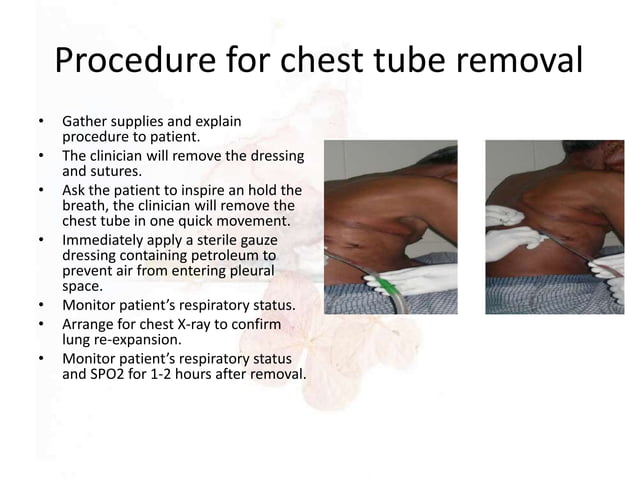 Chest tube insertion ppt (surgery) | PPTX
