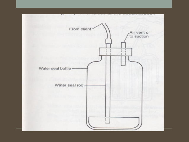 CHEST TUBE & UNDER WATER SEAL | PPT