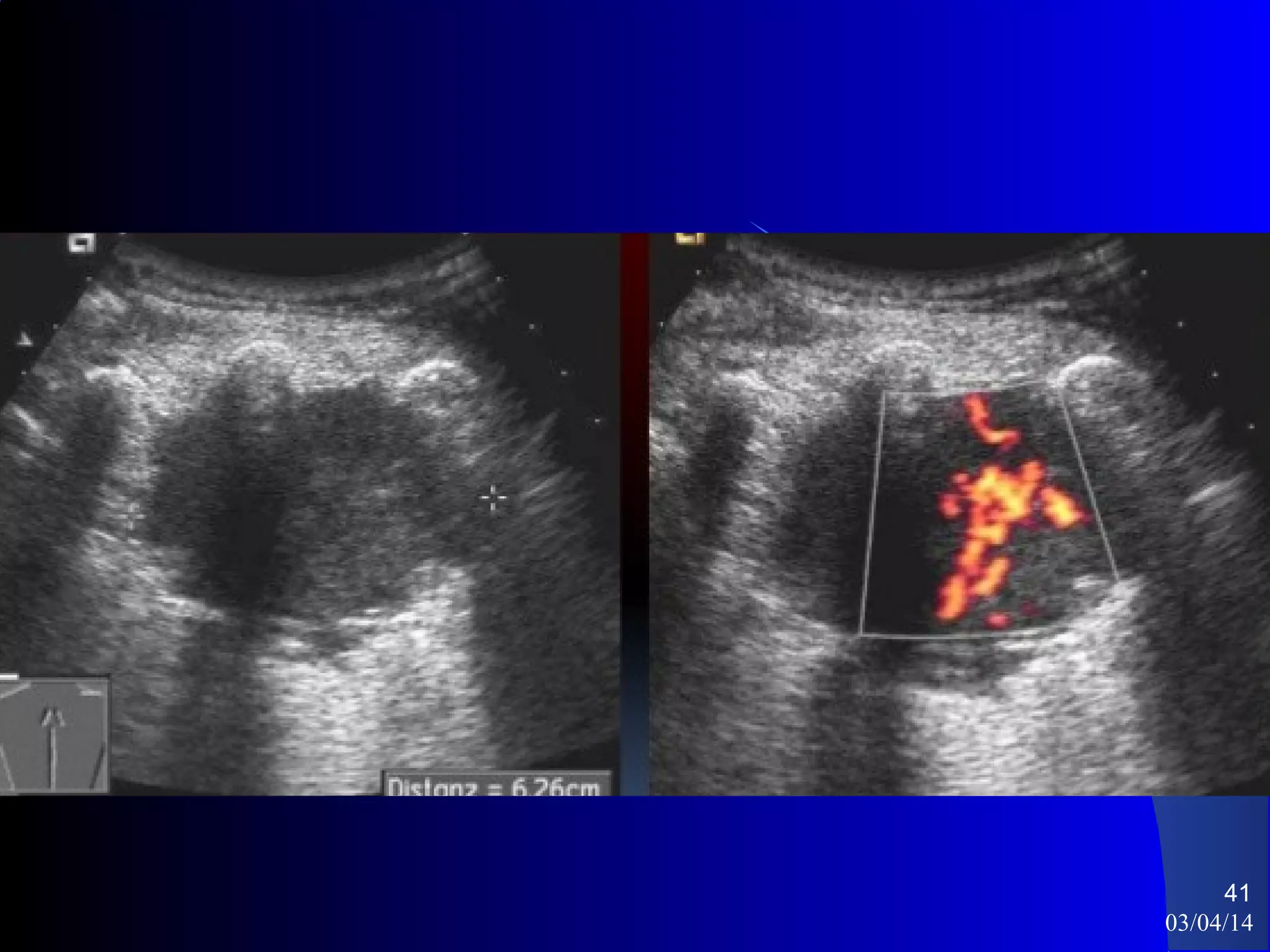 Chest ultrasound | PPT
