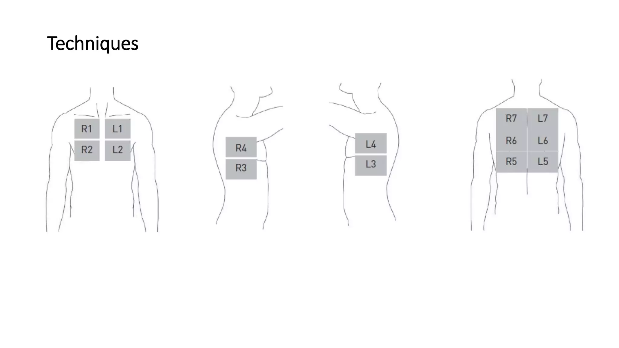 Chest ultrasound in emergency | PPTX
