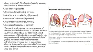 CHEST WALL AND THORACIC CAVITY TRAUMA..pptx