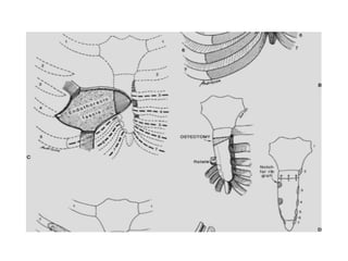 Chest wall deformities | PPT