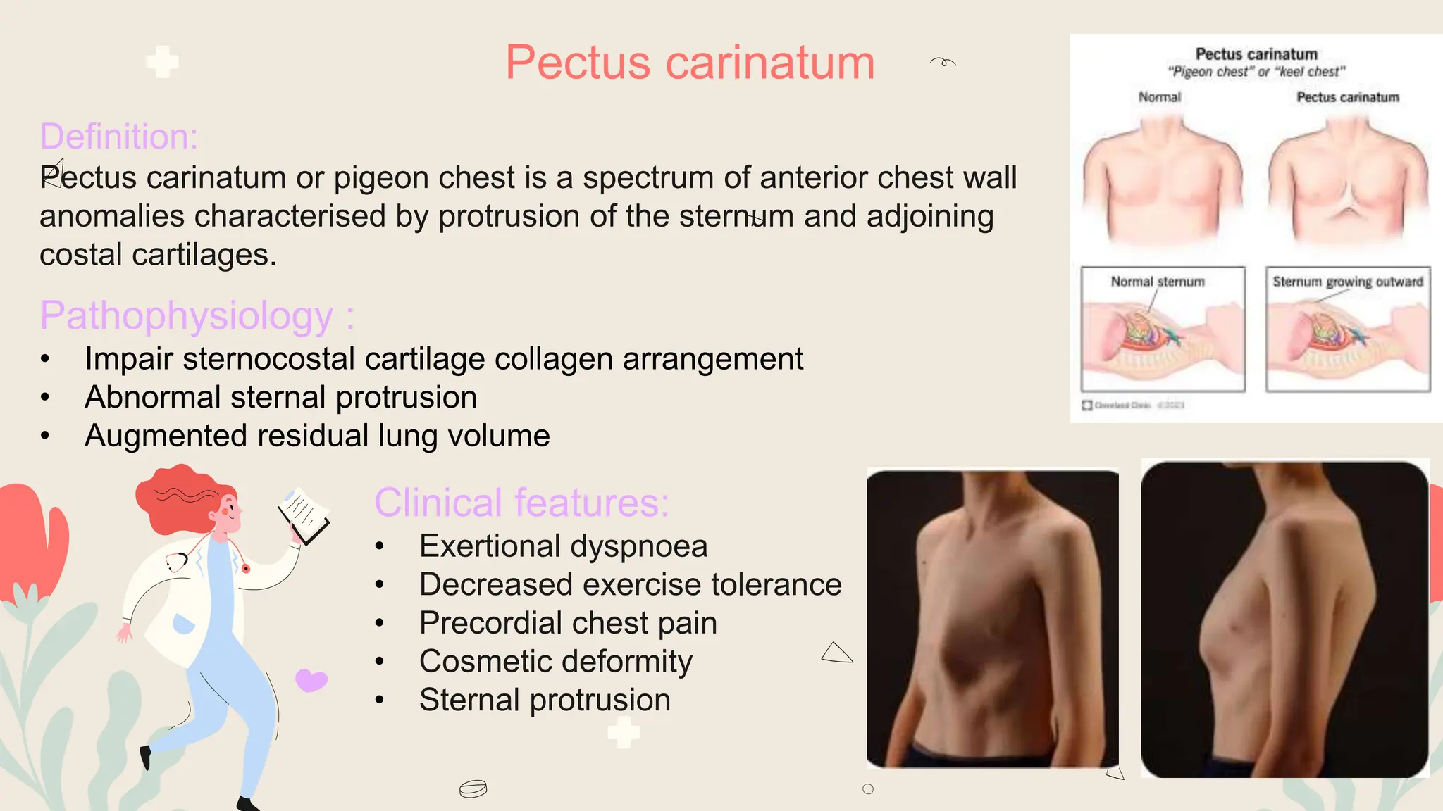 Chest Wall Deformities Pectus Excavatum Pectus Carinatum Etc PPTX