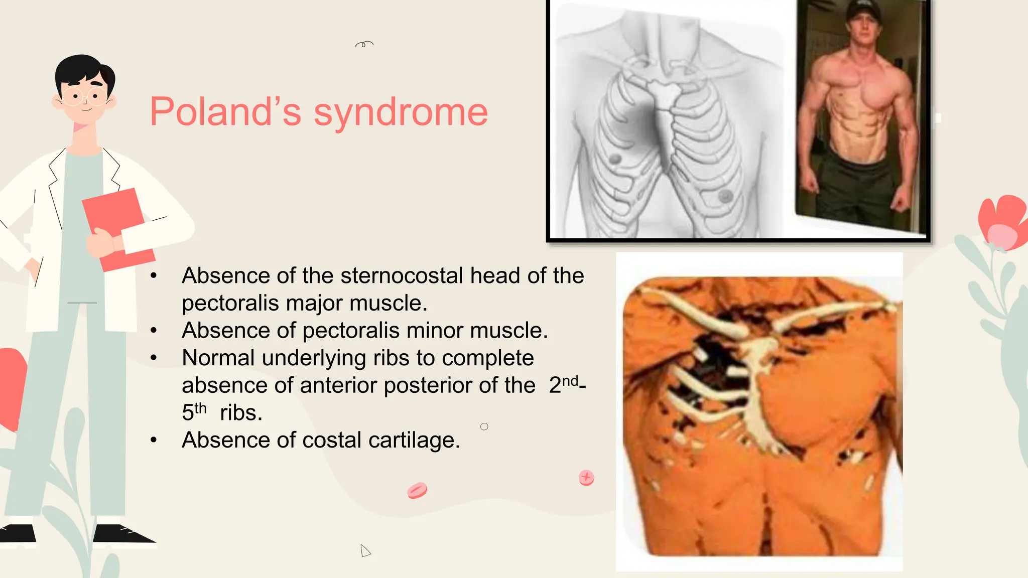 chest wall deformities ( pectus excavatum, pectus carinatum etc.) | PPTX