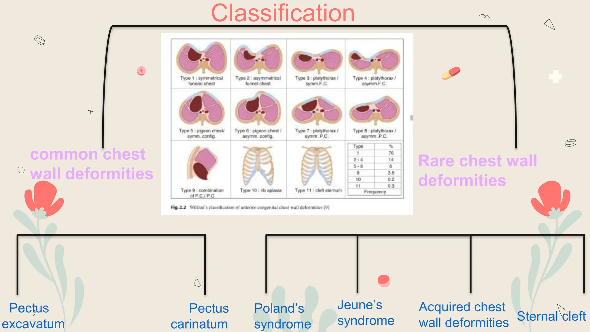 chest wall deformities ( pectus excavatum, pectus carinatum etc.) | PPTX