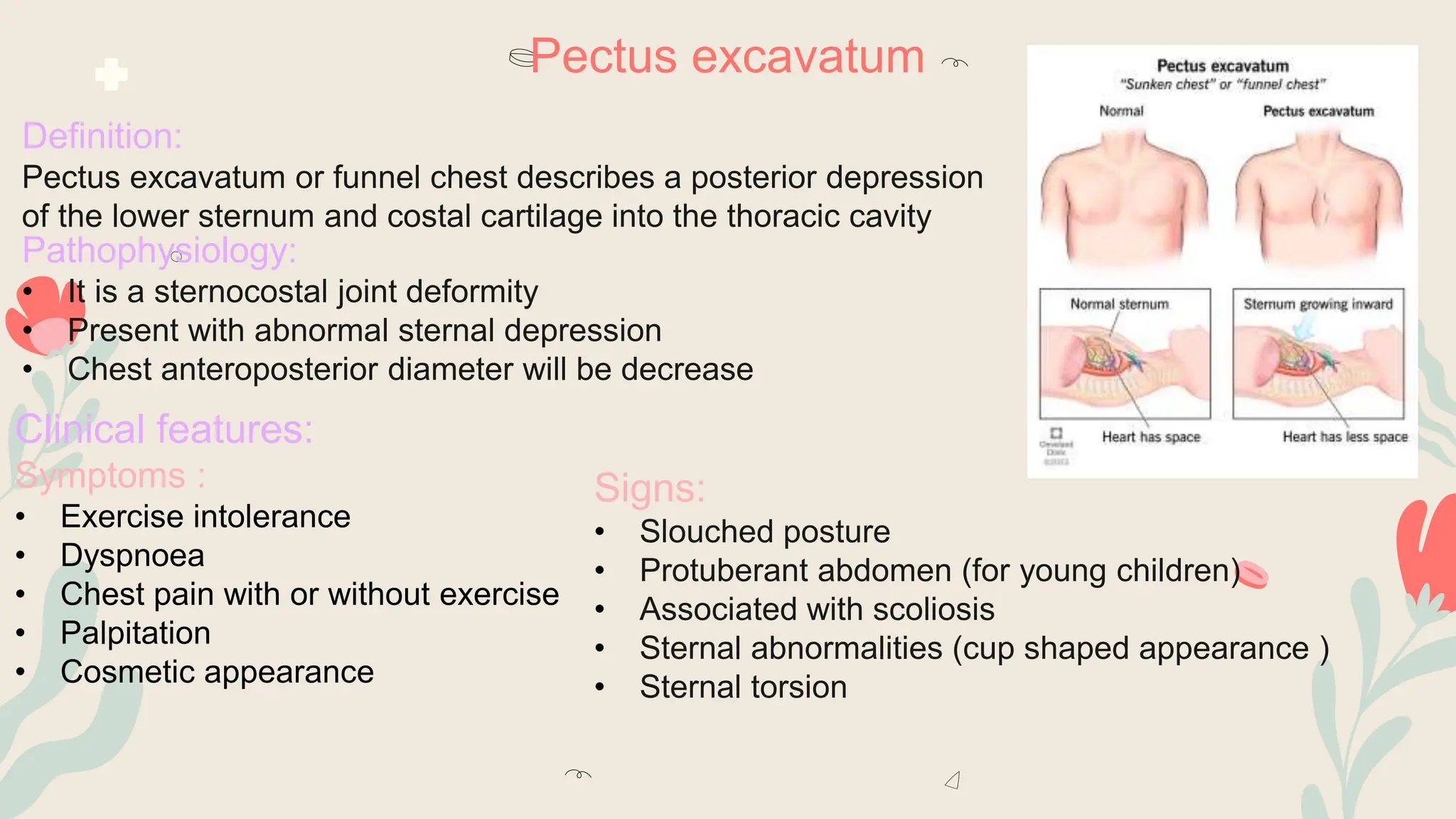 chest wall deformities ( pectus excavatum, pectus carinatum etc.) | PPTX