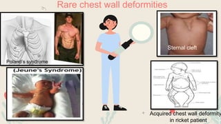 chest wall deformities ( pectus excavatum, pectus carinatum etc.) | PPTX