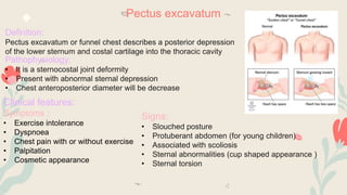 chest wall deformities ( pectus excavatum, pectus carinatum etc.) | PPTX