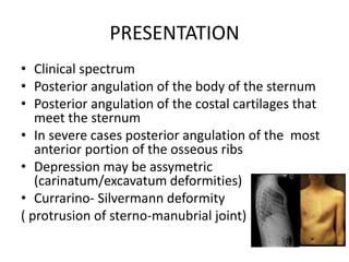 Chest Wall Deformity | PPTX