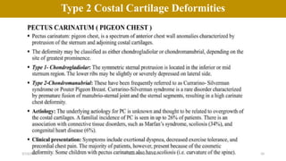 Chest wall deformity by Baasir Umair Khatak.pptx