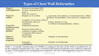 Chest wall deformity by Baasir Umair Khatak.pptx