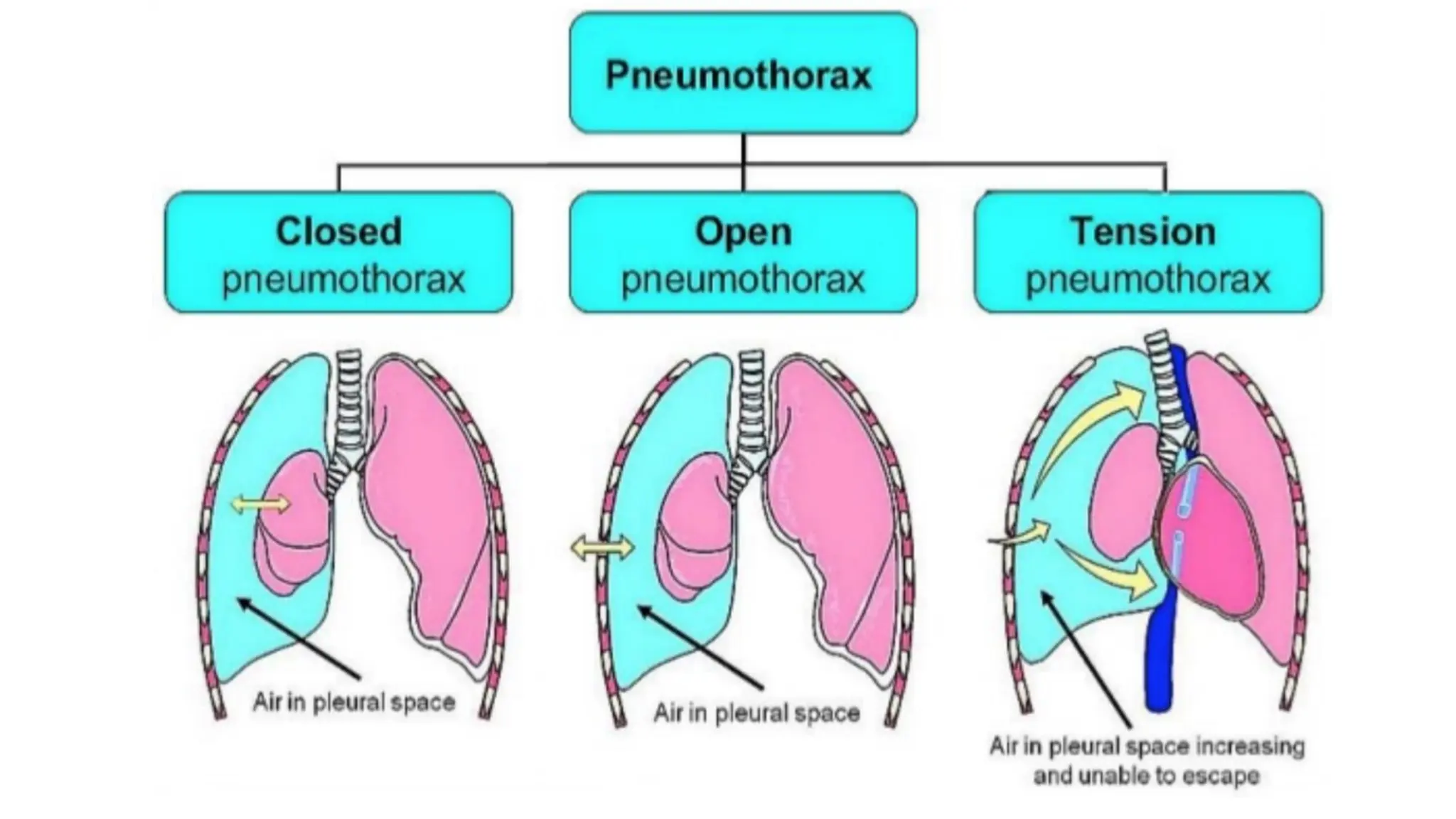 Chest Wall Surgery, Indications, Diagnosis, Management | PDF