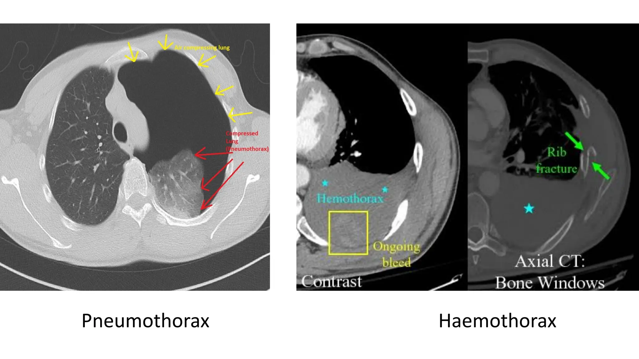 Chest Wall Surgery, Indications, Diagnosis, Management | PDF